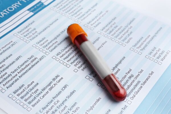 Blood Tests Services Online Chemist UK Pharmacy Online