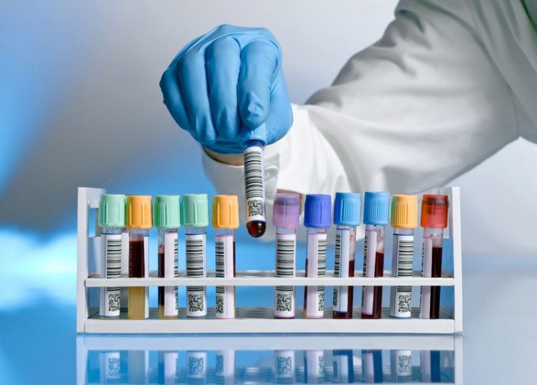 Book Blood Test Online | Blood Test Appointments & Phlebotomy Service